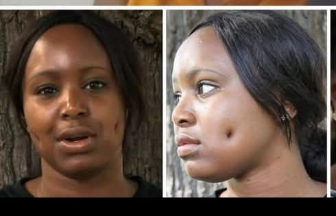 Regret Over Fake Dimples: Nigerian Lady's N3,000,000 Mistake ...